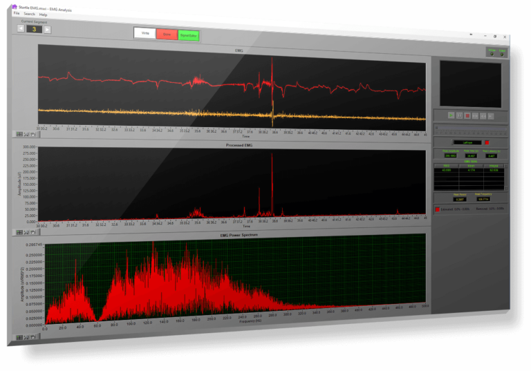 EMG Analysis Software - MindWare Technologies